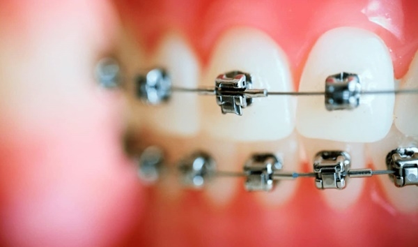 12년만에 서울서 열리는 'Asia Damon Forum'